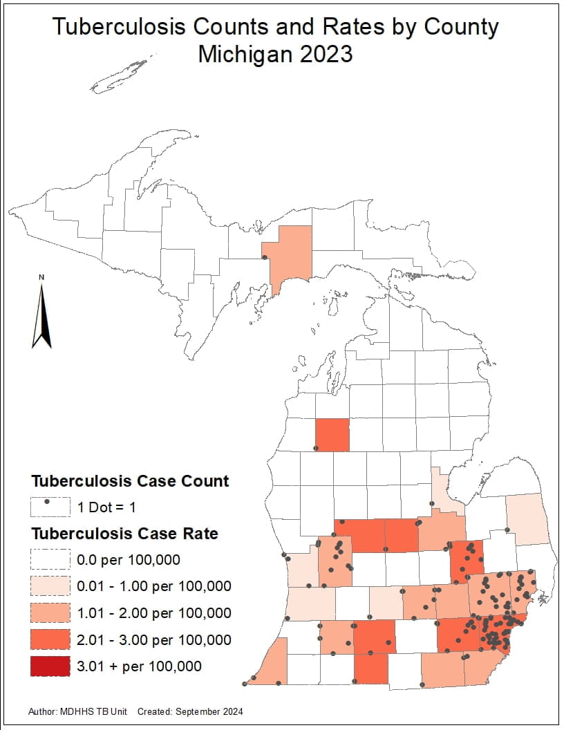 Tuberculosis outbreak in Kansas. How to stay safe in Michigan